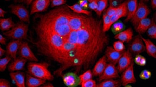 Famous "HeLa" Human Cell Line Gets Its DNA Sequenced - Scientific American