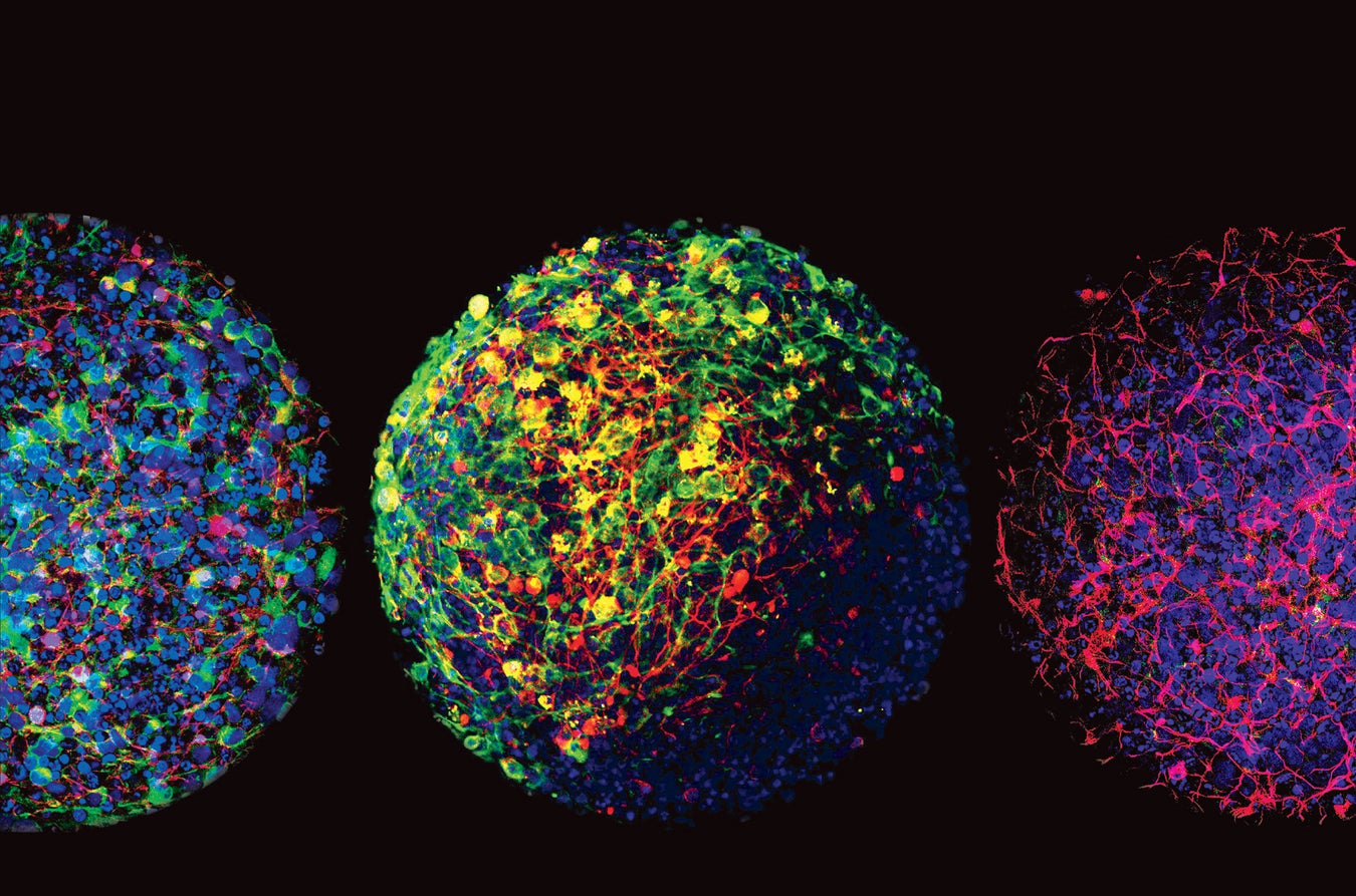 The Beauty of "Mini Brains" | Scientific American