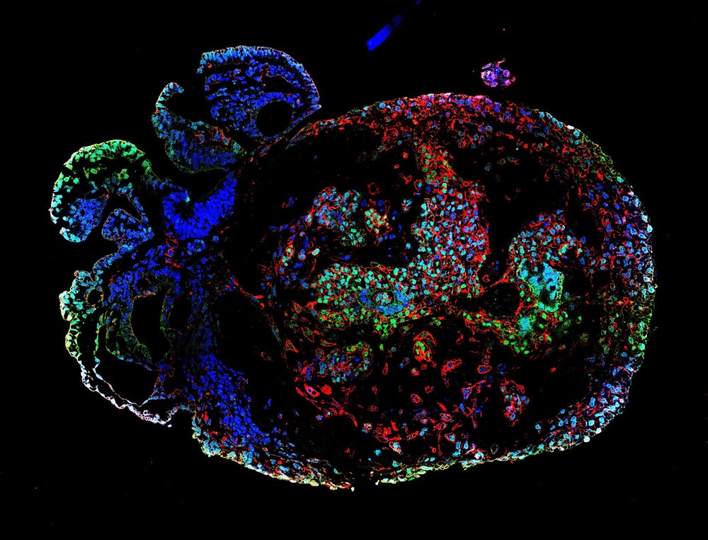 Lab-Grown Monkey Embryos Reveal in 3-D How Organs Begin | Scientific ...