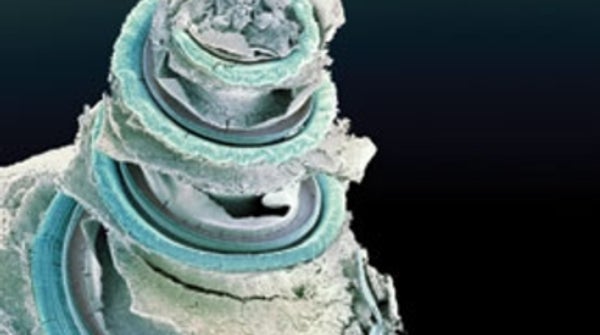 Inner Ear - Scientific American