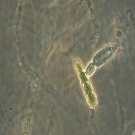 Bugs in Space - Scientific American