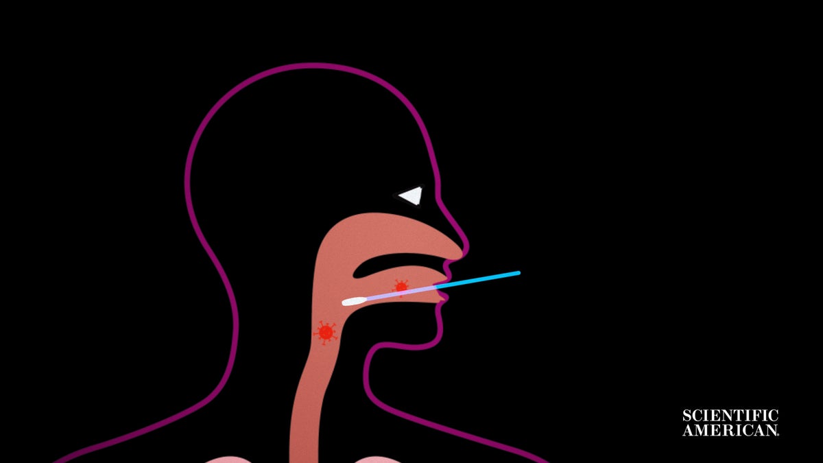 The Science behind How Coronavirus Tests Work | Scientific American