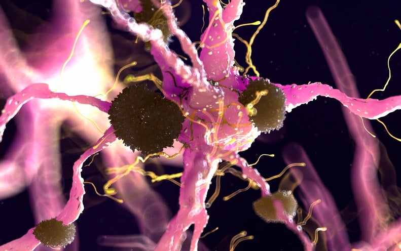 In Shocking Reversal, Biogen to Submit Experimental Alzheimer's Drug ...