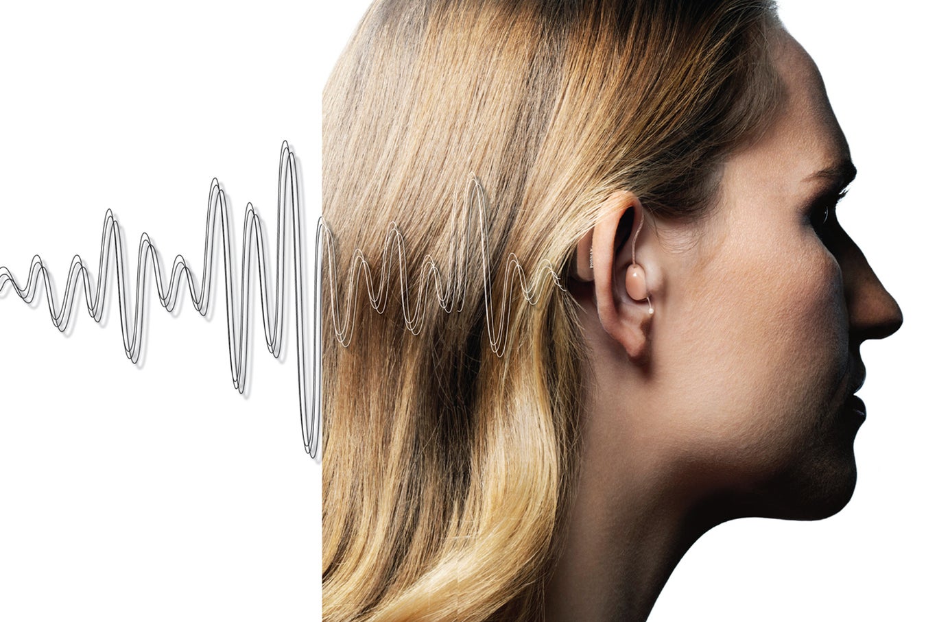 Gene Therapy Tackles a Common Birth Defect: Deafness | Scientific American