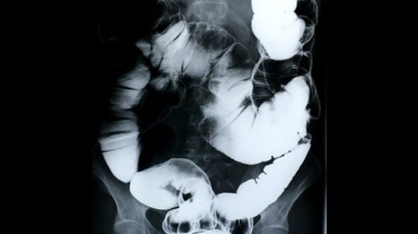 A Trip to "the Poopy Lab" In the Interest of Drug Development ...