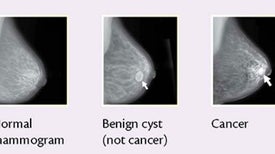 Stories by Rachael Rettner - Scientific American