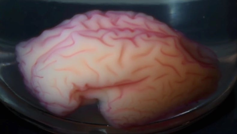 Human Brain's Bizarre Folding Pattern Re-Created in a Vat - Scientific ...